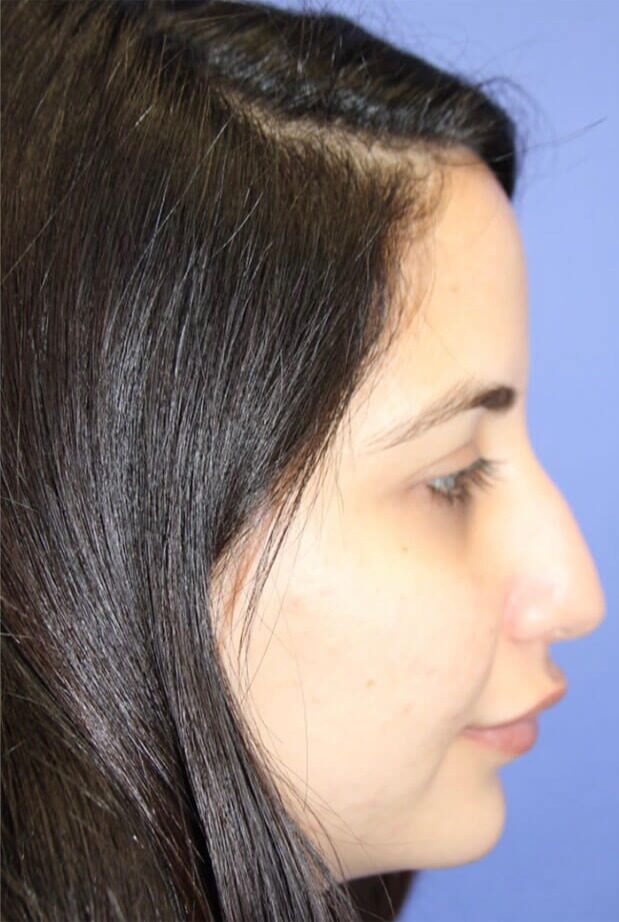 Case #2336 - Dr. Harrison H. Lee Facial Plastic & Cosmetic Surgery